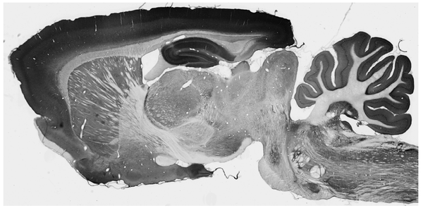 Addgene: Antibody - Anti-KCNT2/Slo2.1/Slick K+ channel [N11/33R]