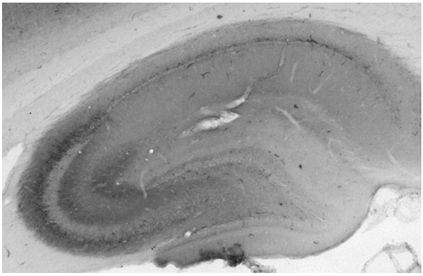 Addgene: Antibody - Anti-HCN2 [N71/37R]