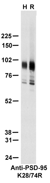 Addgene: Antibody - Anti-PSD-95 [K28/74R]