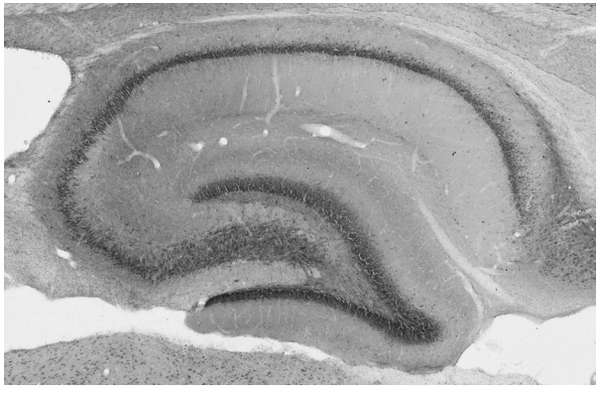 Addgene: Antibody - Anti-Beta4-spectrin [N393/76R]