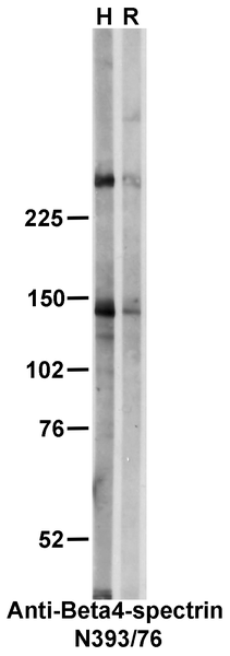 Addgene: Antibody - Anti-Beta4-spectrin [N393/76R]