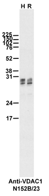 Addgene: Antibody - Anti-VDAC1 [N152B/23R]