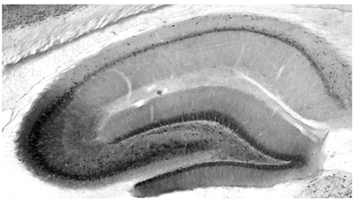 Addgene: Antibody - Anti-TrpC5 [N67/15R]