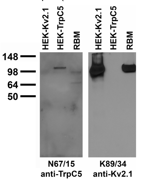 Addgene: Antibody - Anti-TrpC5 [N67/15R]