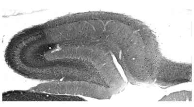 Addgene: Antibody - Anti-Cavbeta2 Ca2+ channel [N8B/1R]