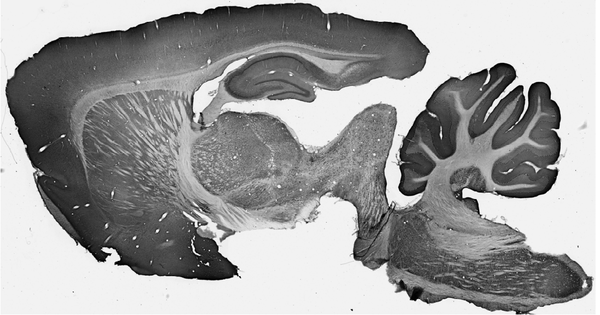 Addgene: Antibody - Anti-VGlut3 [N34/34.2R]