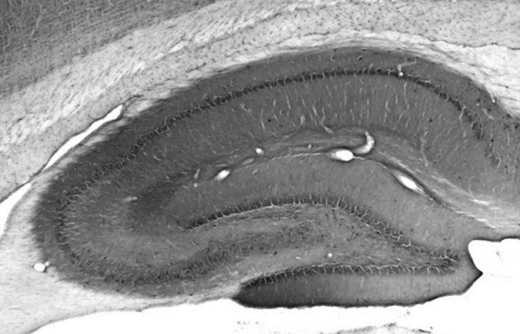Addgene: Antibody - Anti-BK beta4 K+ channel [L18A/3R]
