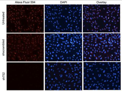 Addgene: Antibody - Anti-Giantin [TA10]