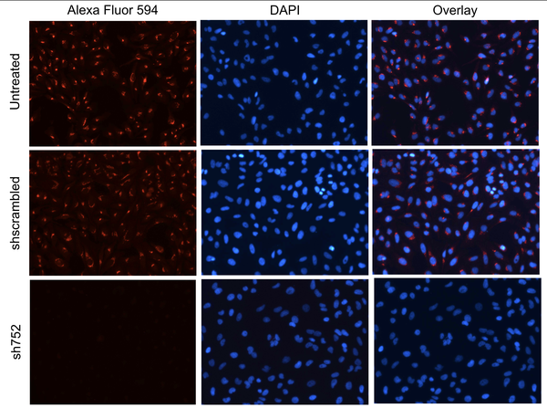 Addgene: Antibody - Anti-Giantin [TA10]