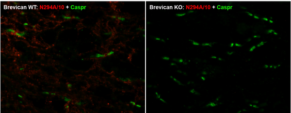 Addgene: Antibody - Anti-Brevican [N294A/10R]