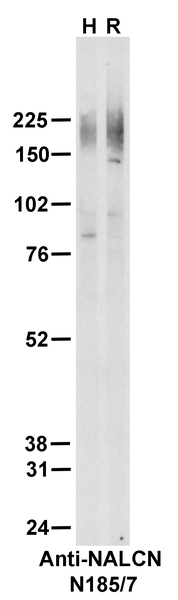 Addgene: Antibody - Anti-NALCN [N185/7R]