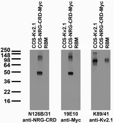 Addgene: Antibody - Anti-Neuregulin-CRD [N126B/31R]