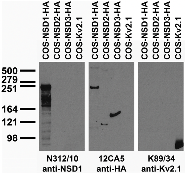 Addgene: Antibody - Anti-NSD1 [N312/10]
