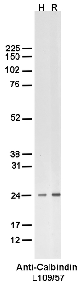 Addgene: Antibody - Anti-Calbindin [L109/57R]