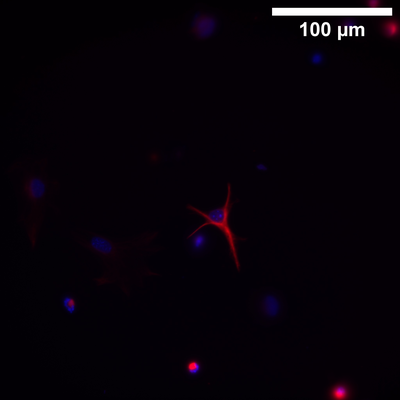 Addgene: Antibody - Anti-GFAP [N206A/8R]