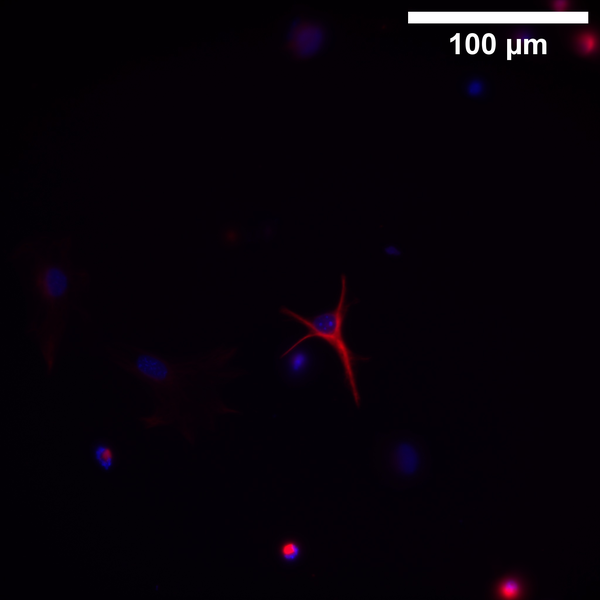 Addgene: Antibody - Anti-GFAP [N206A/8R]