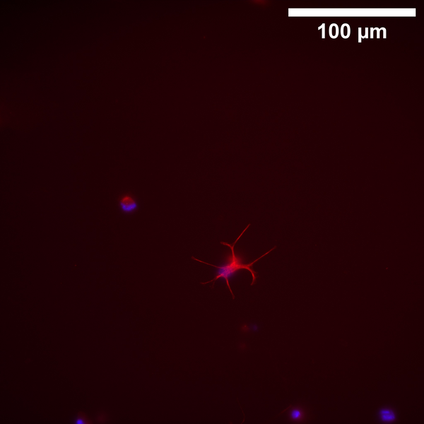 Addgene: Antibody - Anti-GFAP [N206A/8R]