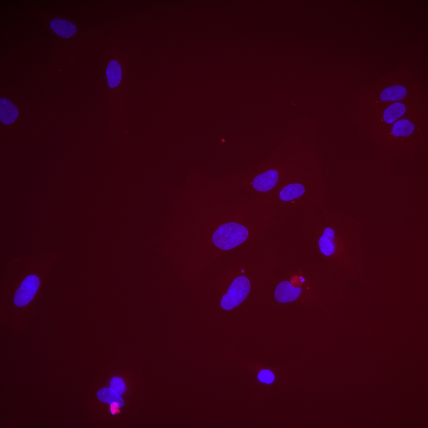 Addgene: Antibody - Anti-GFAP [N206A/8R]