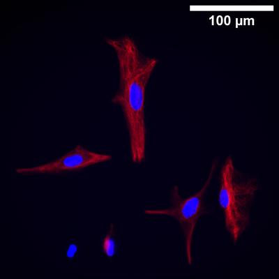 Addgene: Antibody - Anti-GFAP [N206A/8R]