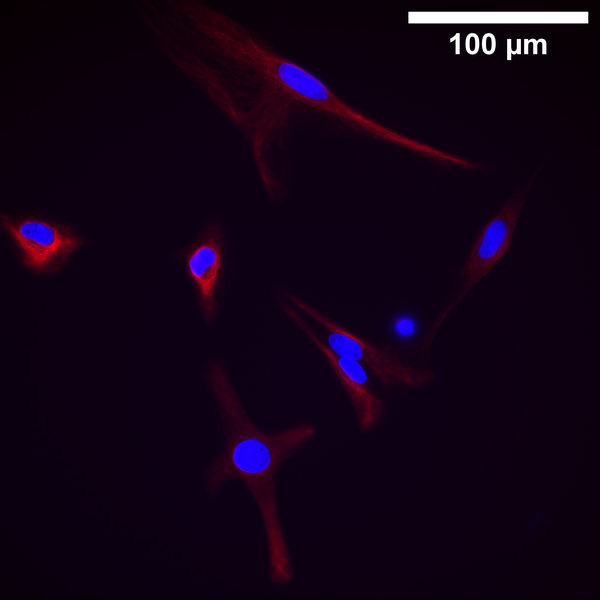 Addgene: Antibody - Anti-GFAP [N206A/8R]