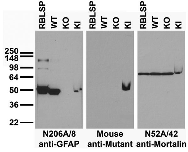 Addgene: Antibody - Anti-GFAP [N206A/8R]