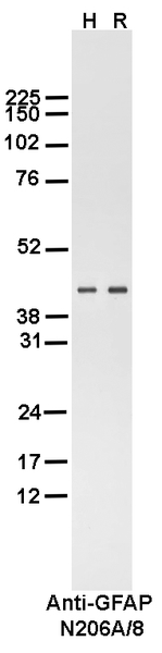 Addgene: Antibody - Anti-GFAP [N206A/8R]