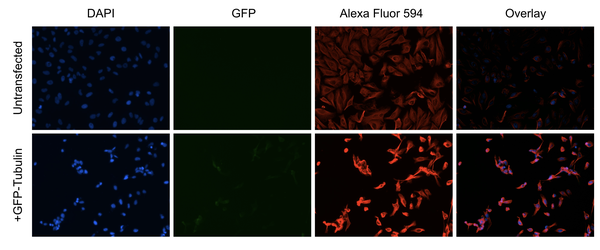 Addgene: Antibody - Anti-Alpha-Tubulin [F2C]